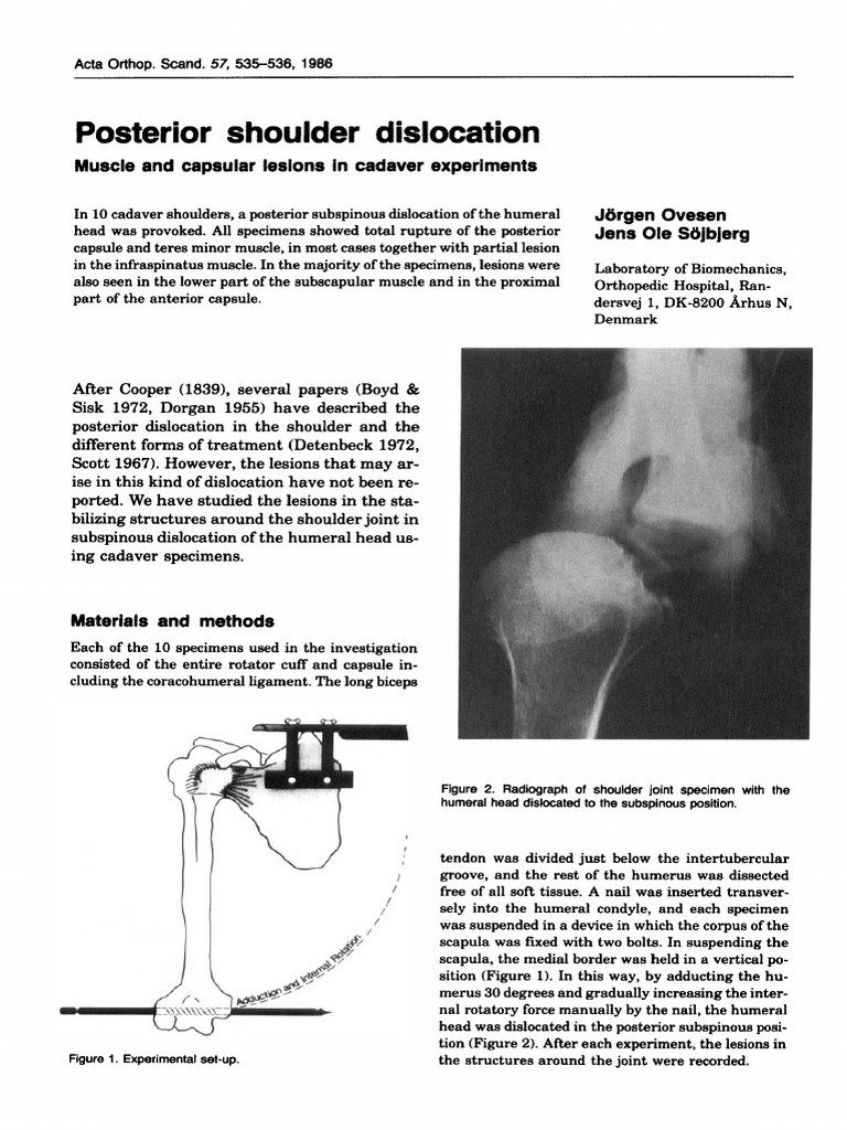 Posterior Shoulder Dislocation Lesions | PDF | Shoulder ...