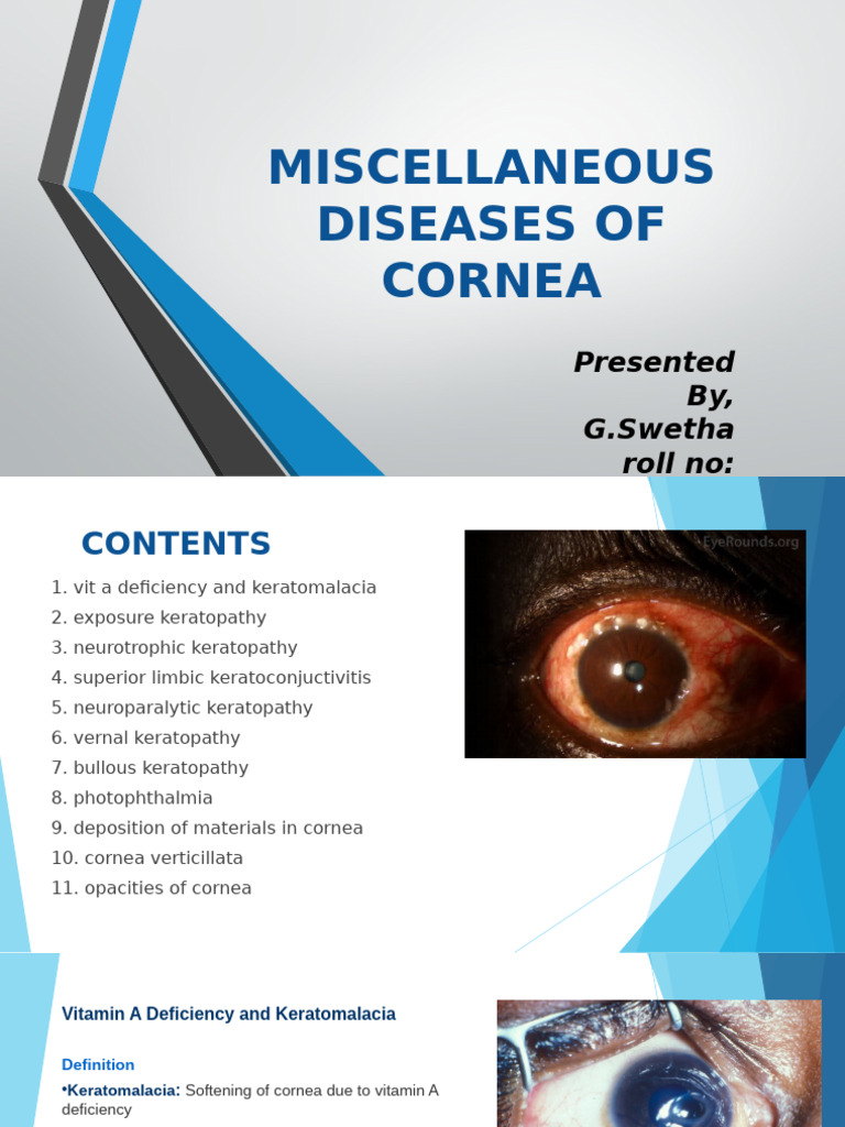 Corneal Diseases: Types and Treatments | PDF | Cornea | Diseases And ...