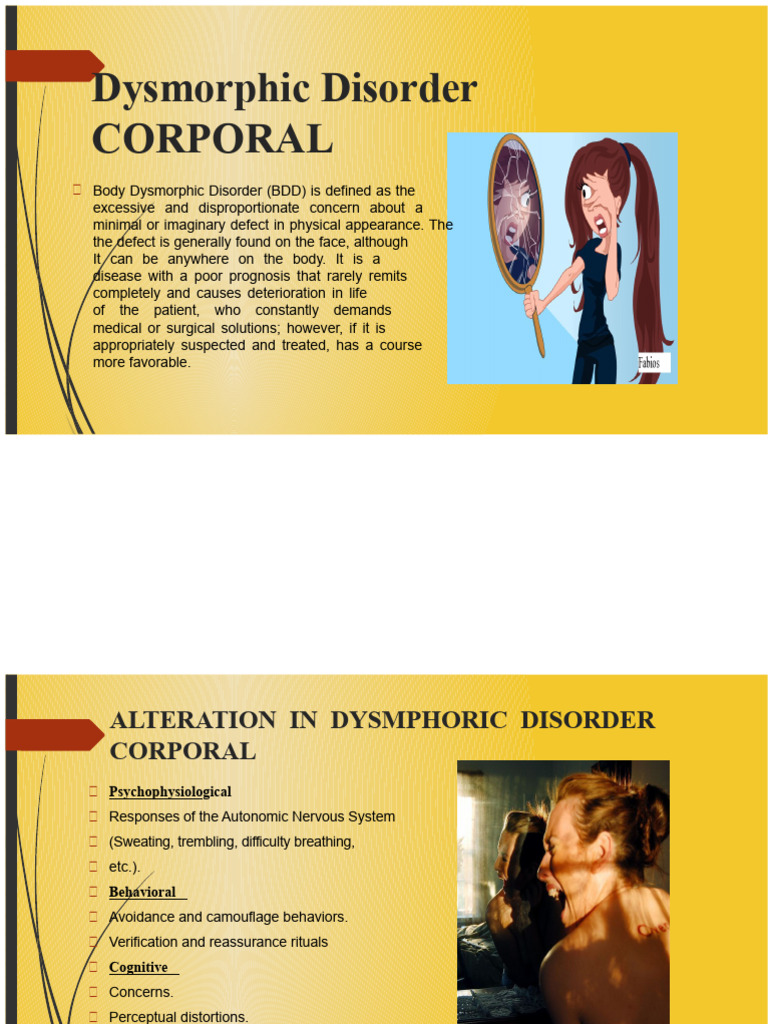 BODY DYSMORPHIC DISORDER.pptx | PDF | Mental Disorder | Obsessive ...