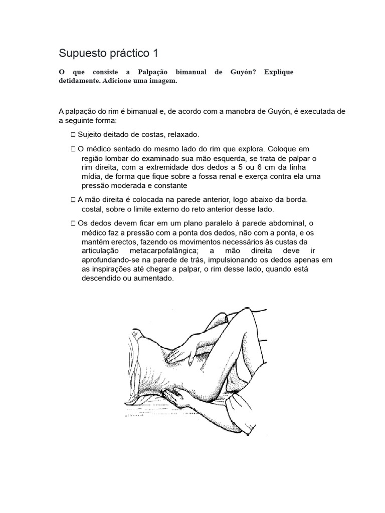 Palpação Bimanual de Guyón: Guia Prático | PDF