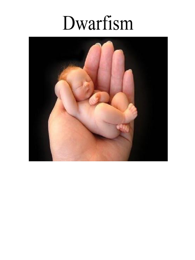 Dwarfism | PDF | Growth Hormone | Endocrine Diseases