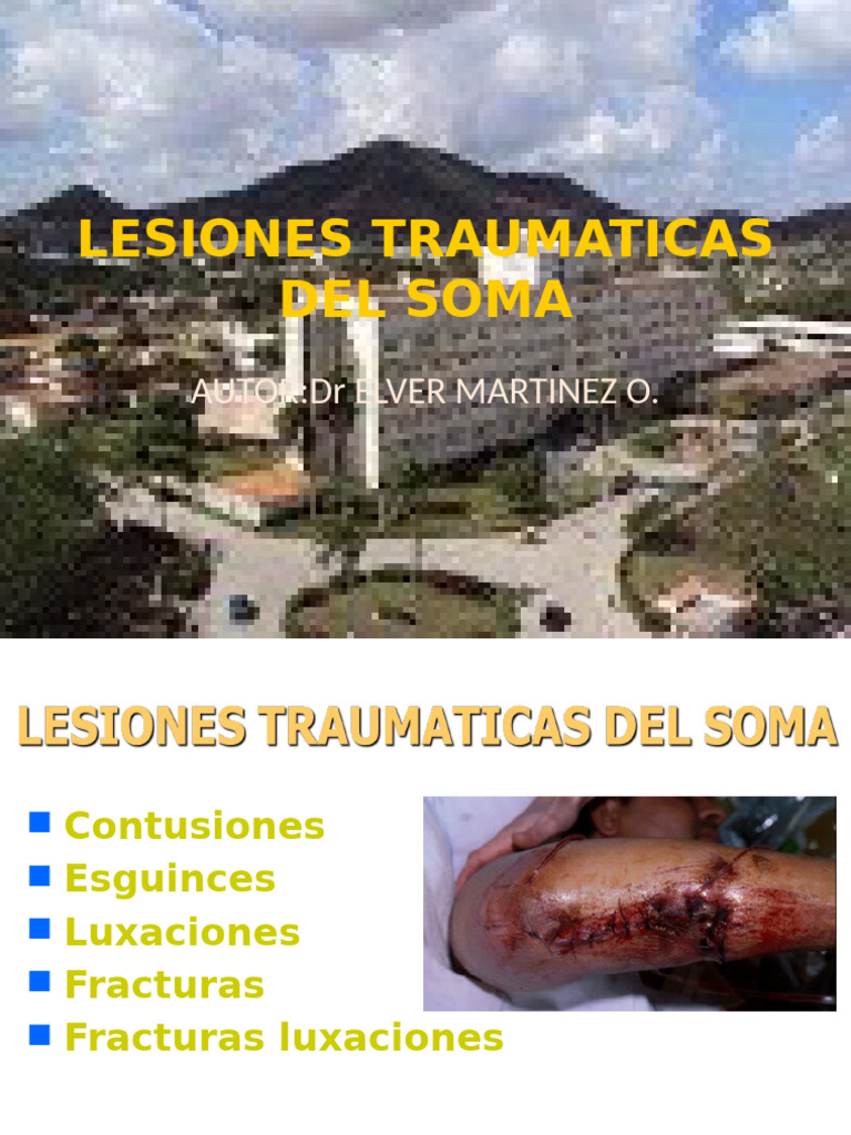 Tratamiento de Lesiones Traumáticas | PDF | Traumatologia ...