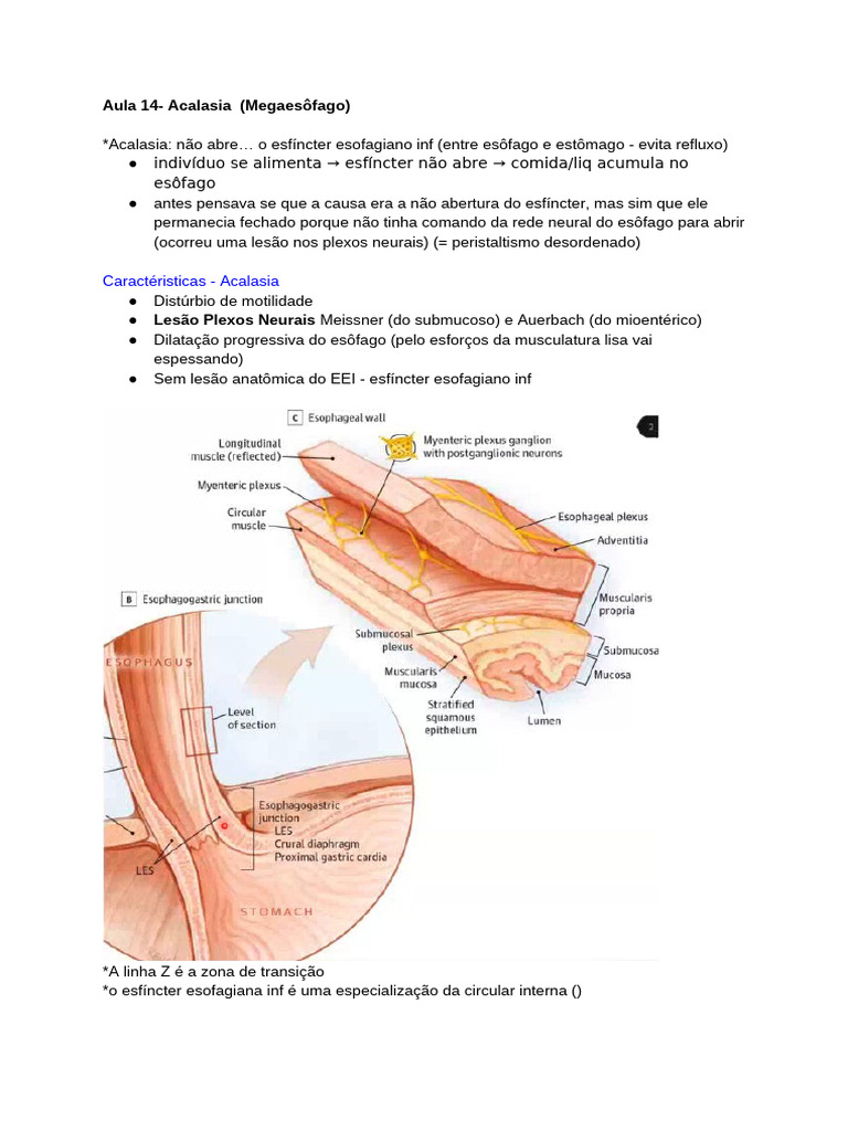 Cópia de Aula 8 - Acalasia - Megaesôfago | PDF | Esôfago | Doença do ...