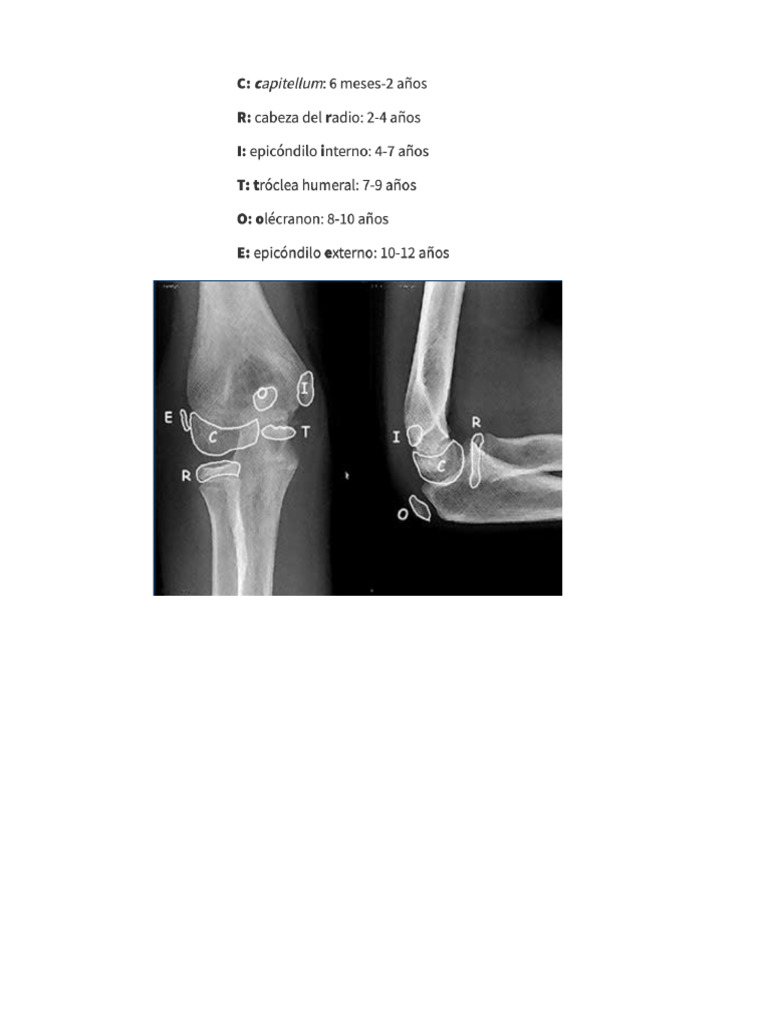 CRITOE | PDF