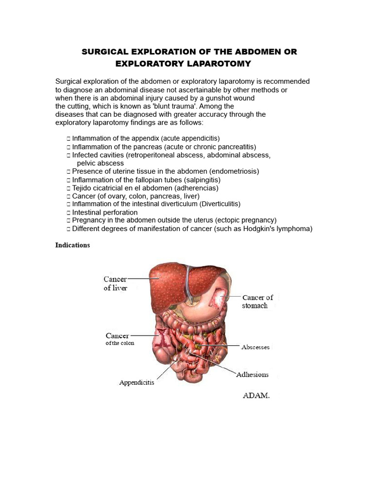 Surgical exploration of the abdomen or exploratory laparotomy | PDF ...
