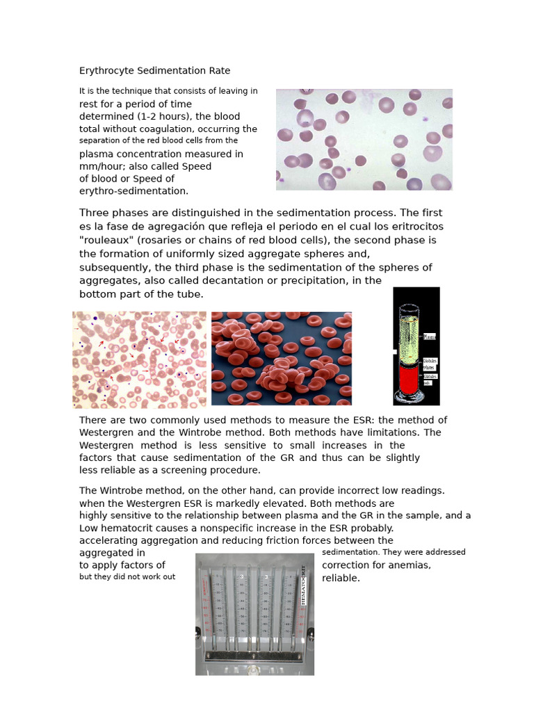 Erythrocyte Sedimentation Rate (1) | PDF | Anemia | Hemoglobin