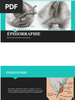 Syndrome de la Jonction Pyelo-Uréterale | PDF | Rein | Spécialités ...