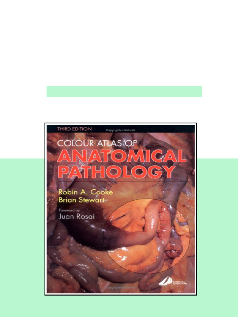 (Ebook) Colour Atlas of Anatomical Pathology by Robin A. Cooke, Brian ...