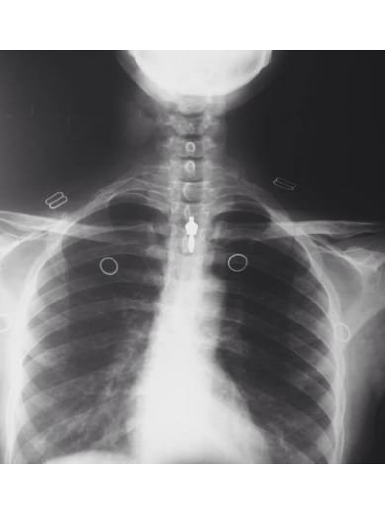 X Rays Surgery | PDF