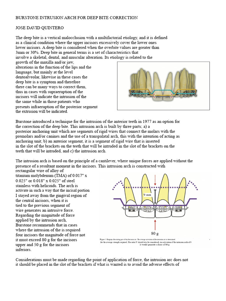 Burstone Intrusion Arch For Deep Bite Correction | PDF | Dentistry ...