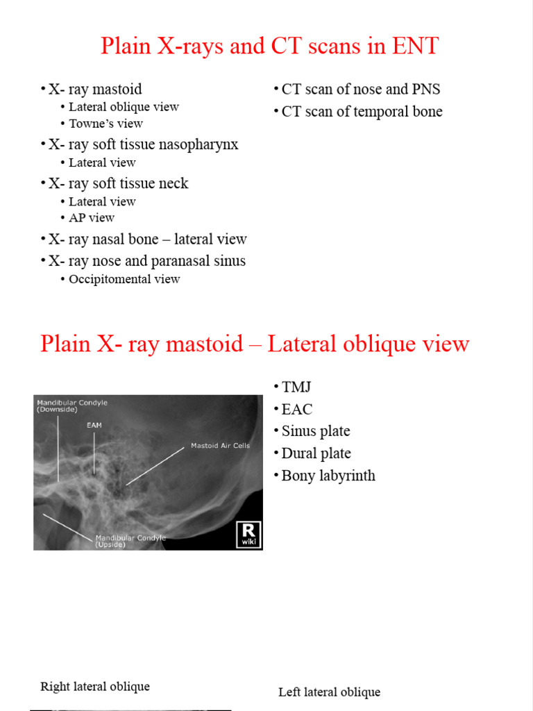 ENT Imaging: X-rays and CT Scans Guide | PDF | Human Nose | Primate Anatomy