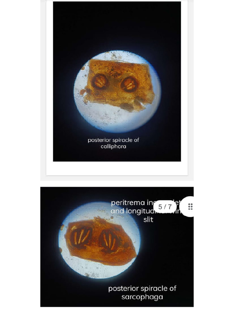 Posterior Spiracles | PDF