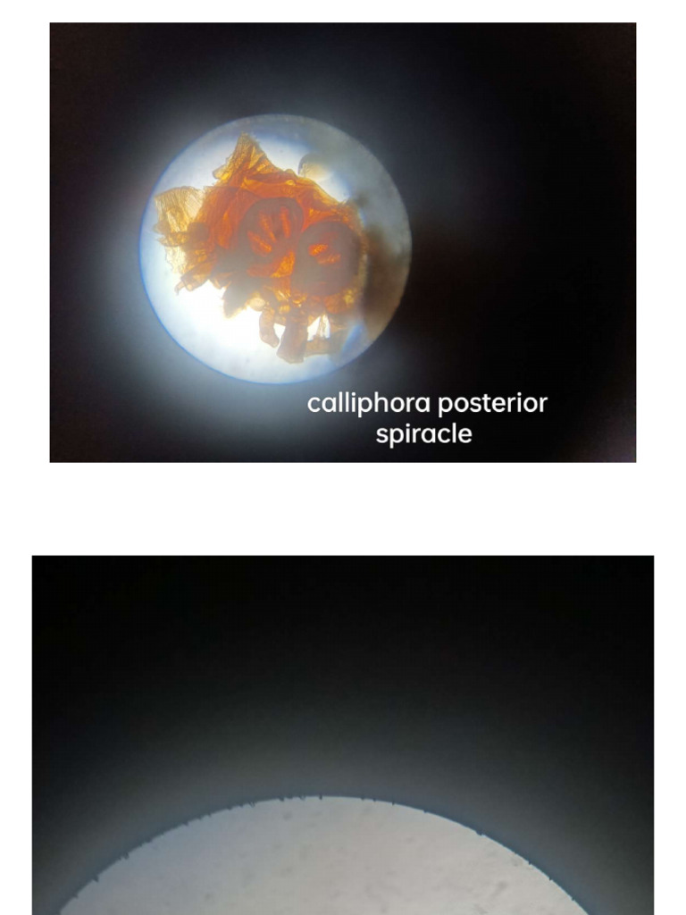 Posterior Spiracle of Dipteran Larva_compressed | PDF