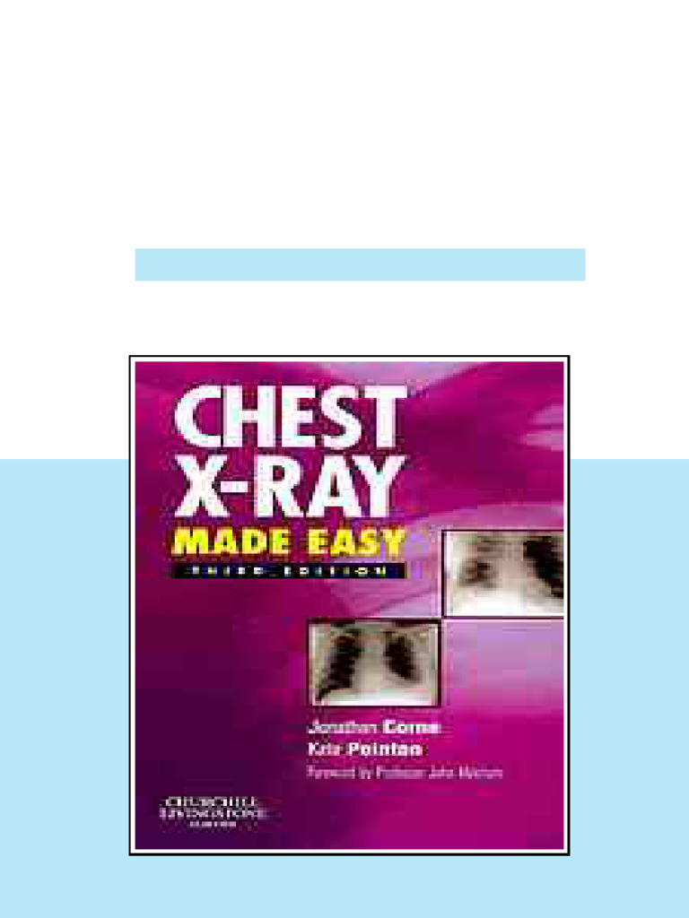 (Ebook) Chest x-ray made easy by Jonathan Corne; Kate Pointon ISBN ...