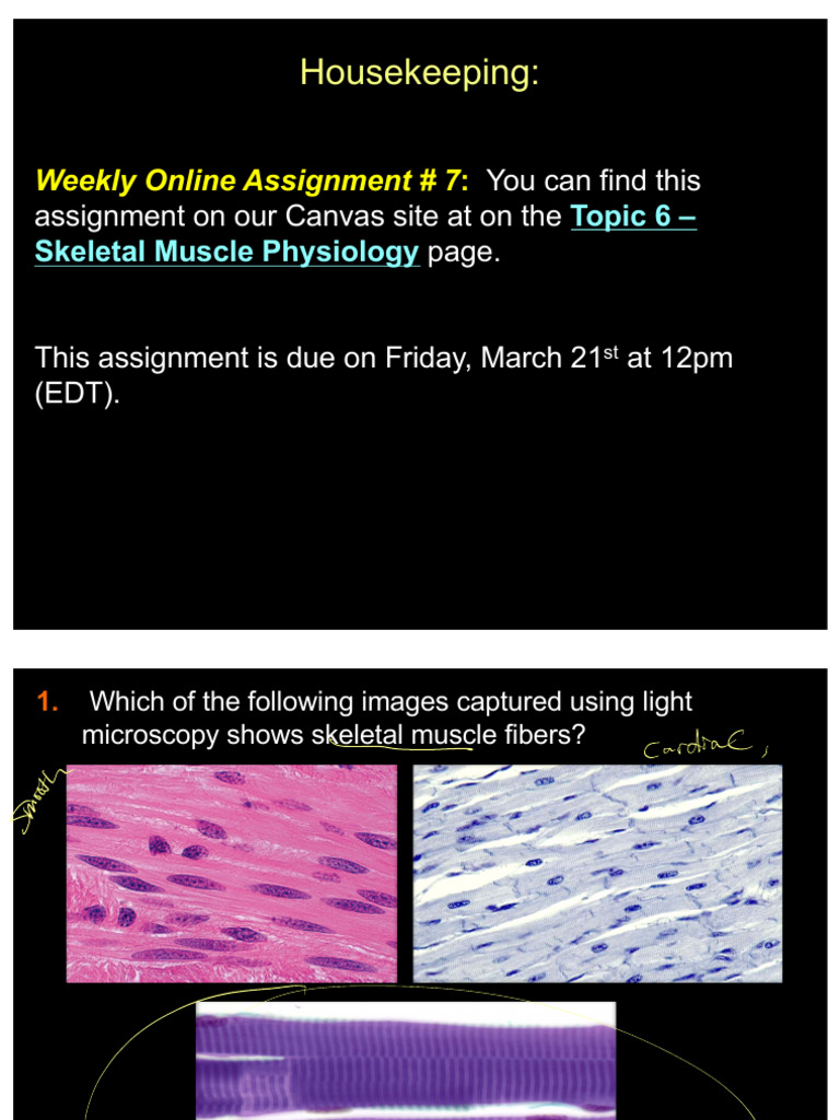 Lecture+16+Skeletal+Muscle+Physiology | PDF | Skeletal Muscle | Muscle Contraction