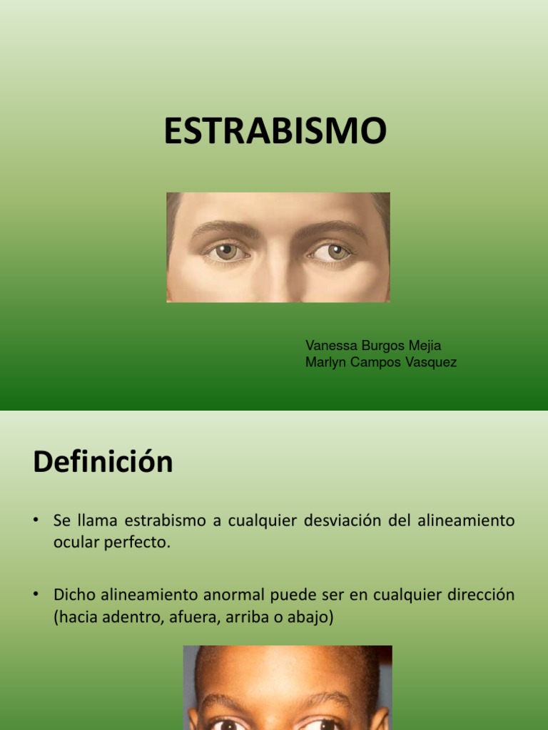 Estrabismo Final | PDF | Percepción visual | Sistema visual