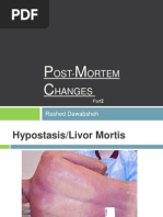 Stages of Post Mortem Lividity and Putrefaction of The Body | PDF ...