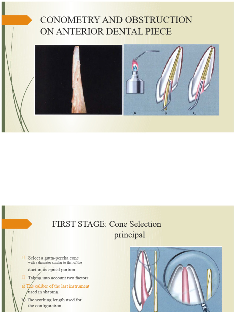 Anterior Dental Cone Obstruction Guide | PDF | Dentistry Branches