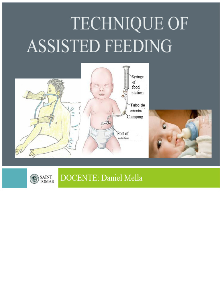 Assisted Feeding Technique | PDF | Intravenous Therapy | Medical ...