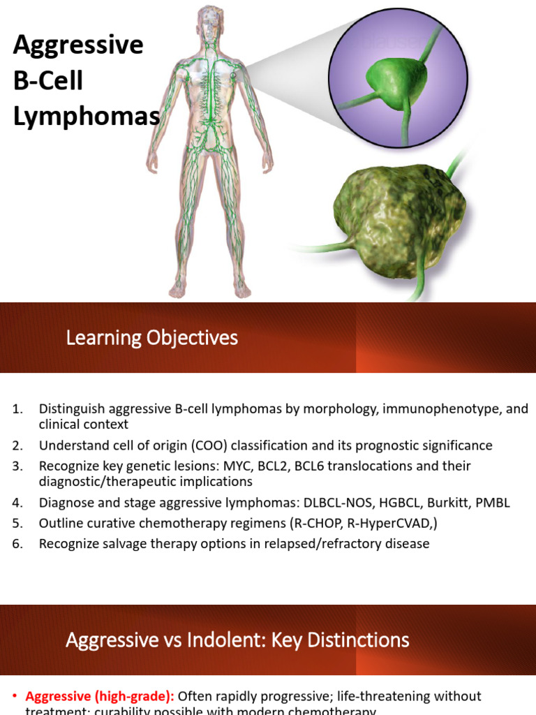 Aggressive B-Cell Lymphomas Overview | PDF | Lymphoma | Medical Specialties