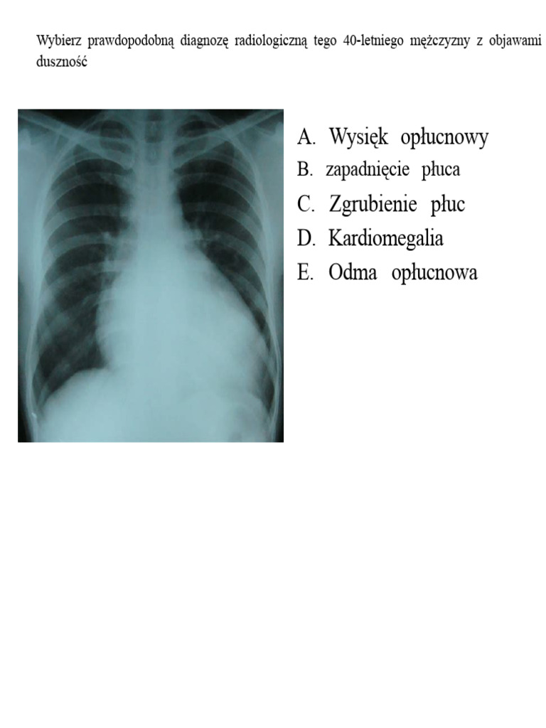 TEST ZDJĘCIOWY MDCN - Medycyna Wewnętrzna | PDF