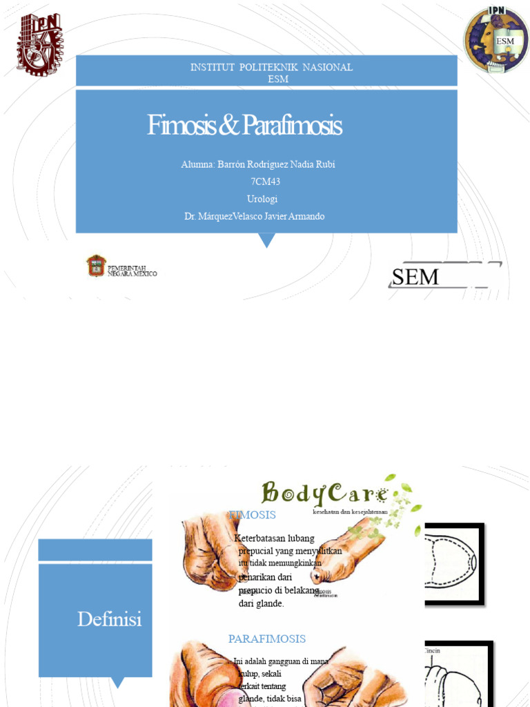 Fimosis Parafimosis | PDF