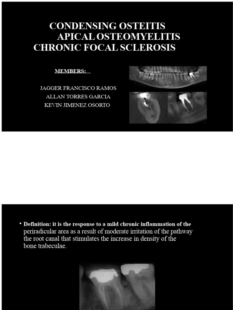 CONDENSING OSTEITIS IMAGING.pptx | PDF | Bone | Osteoblast