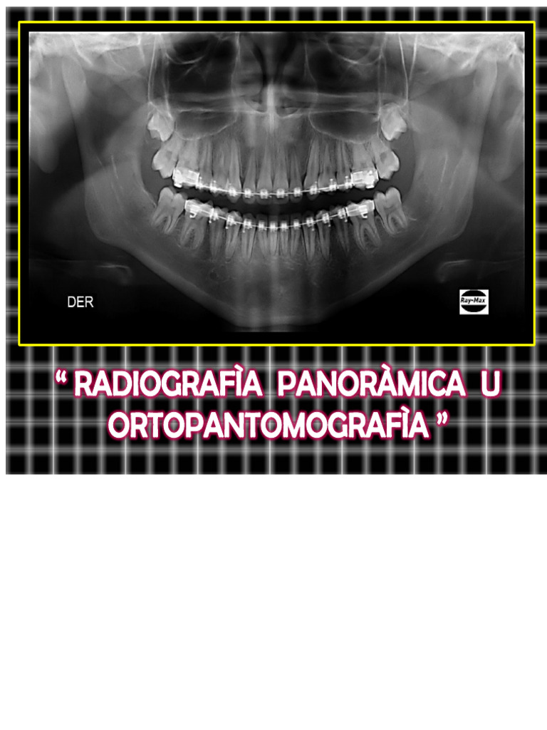 Panoramic Radiography - Power Point | PDF