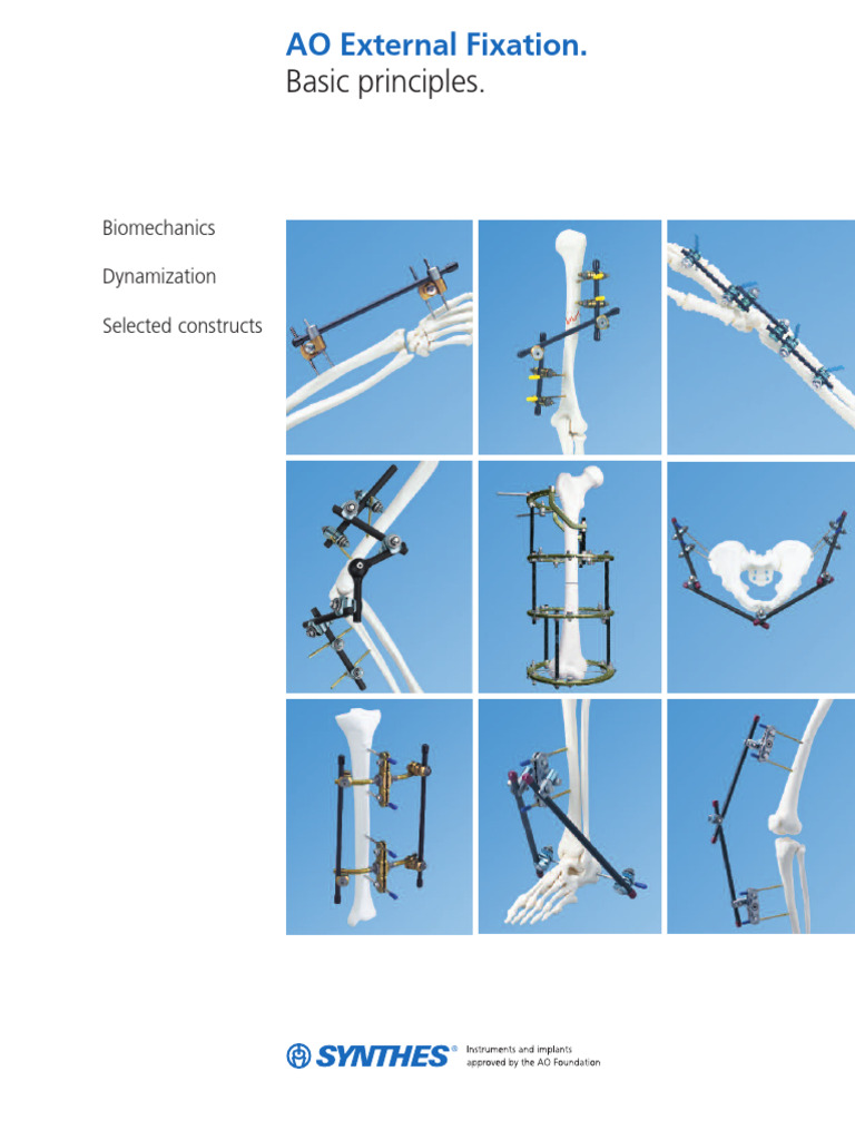 AO External Fixation Basic Principles | PDF | Screw | Bone