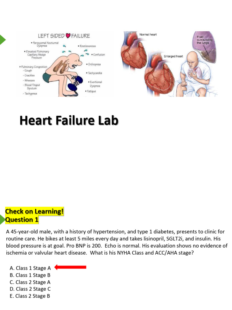 Heart Failure Management and Staging Guide | PDF | Heart Failure ...