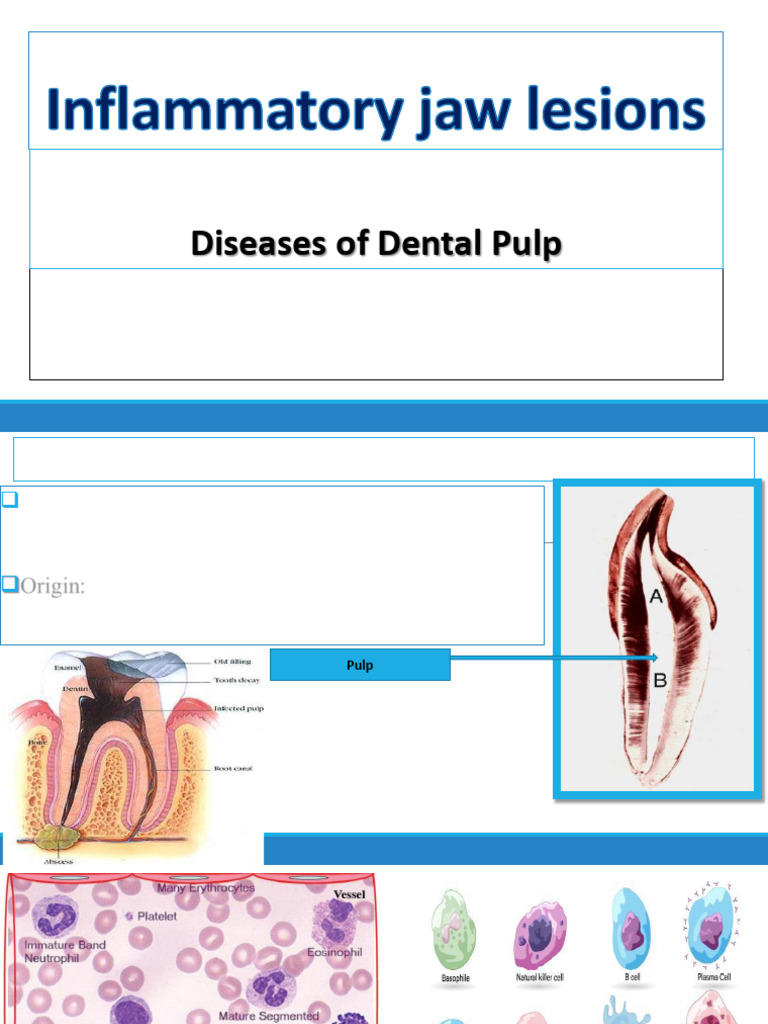 5- Diseases of Pulp | PDF | Human Tooth | Medical Specialties