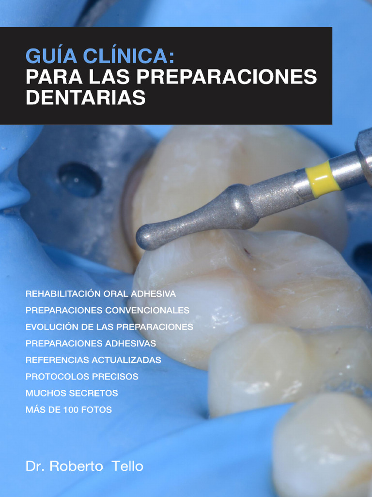 ROA Preparaciones Dentarias TELLO | PDF
