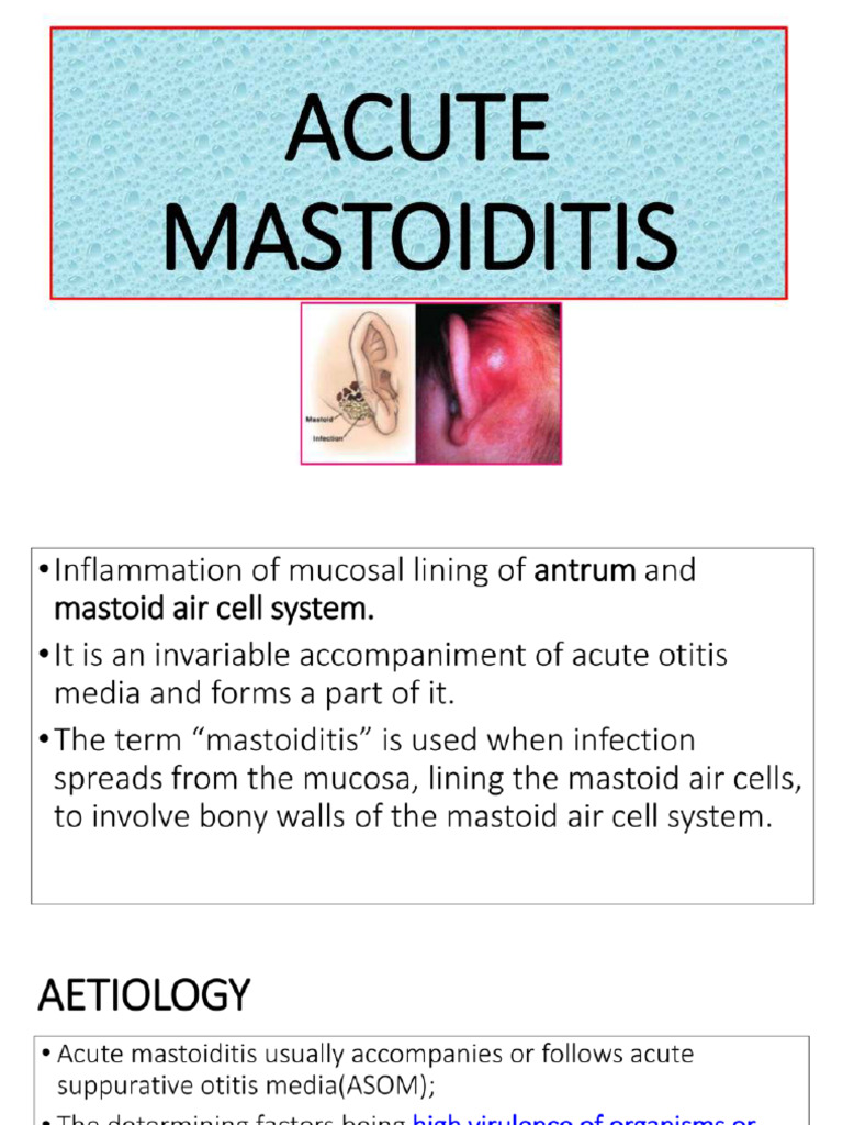 12.acute Mastoiditis Otalgia Otorrhea | PDF