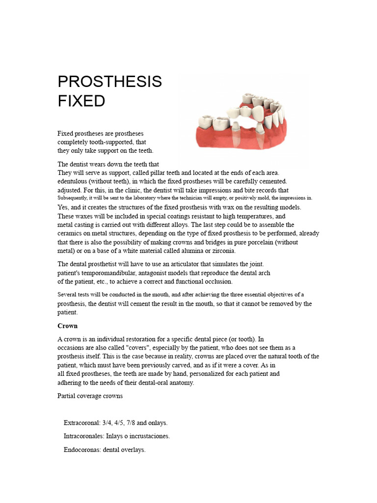 Fixed Dental Prostheses Overview | PDF | Tooth | Materials