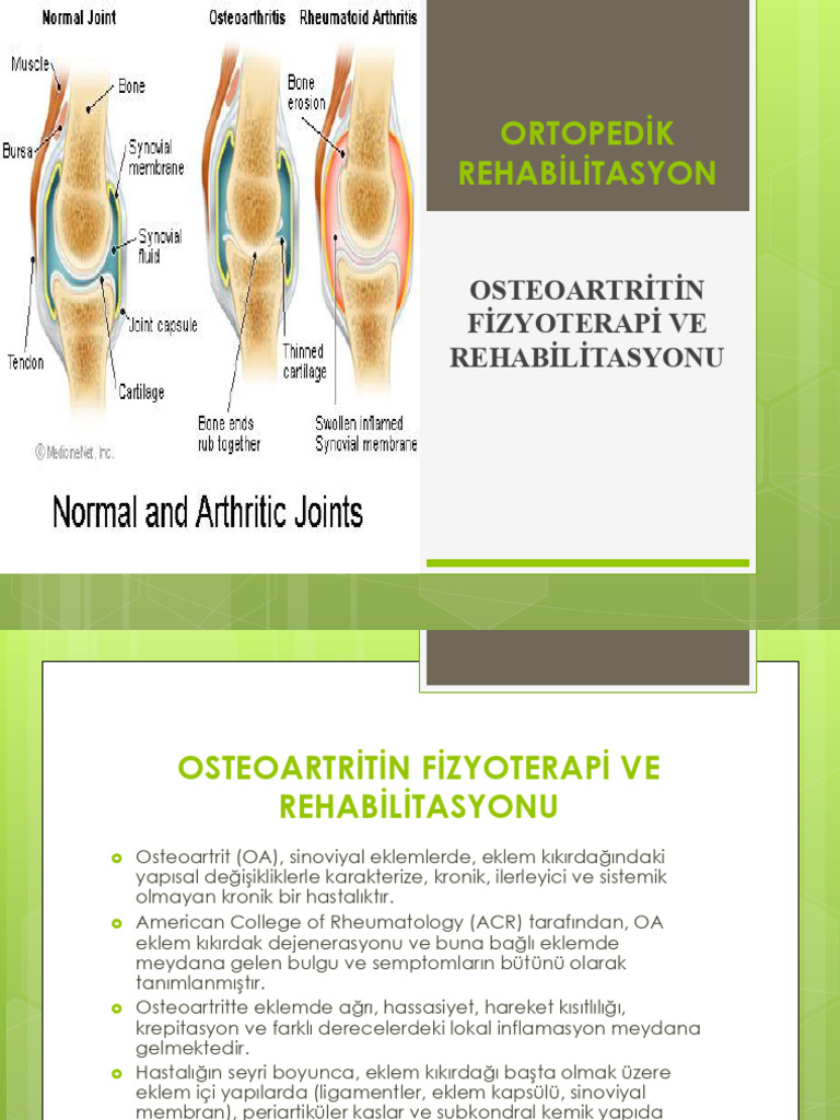 6. 1. hft. Ortopedik Rehabltasyon OSTEOARTRİTİN FİZYOTERAPİ VE ...