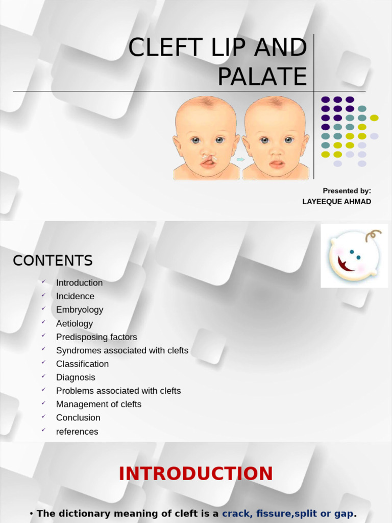 Cleft Lip and Palate (La) | PDF | Human Tooth | Orthodontics