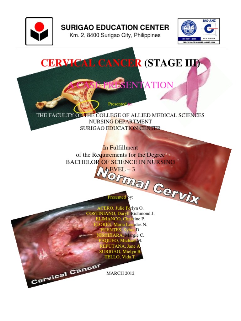 Cervical Cancer Stage 2