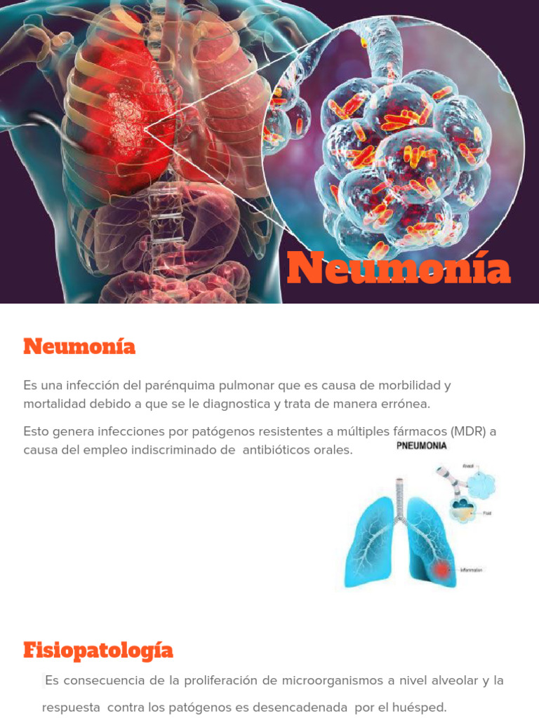 Guía Completa sobre Neumonía y Tratamiento | PDF | Neumonía | Microbiología
