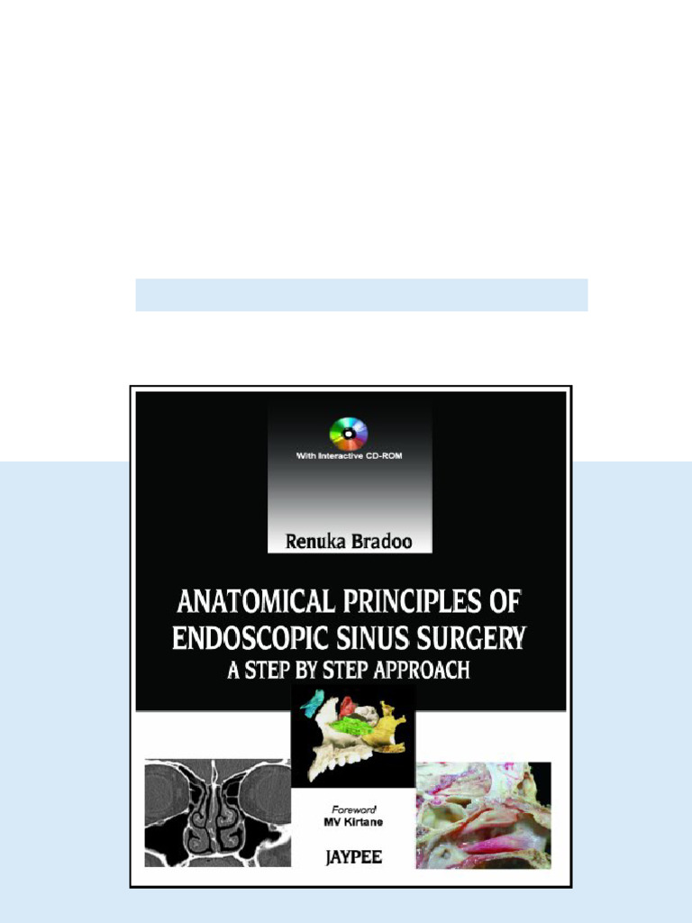 (Ebook) Anatomical Principles of Endoscopic Sinus Surgery by Bradoo ...