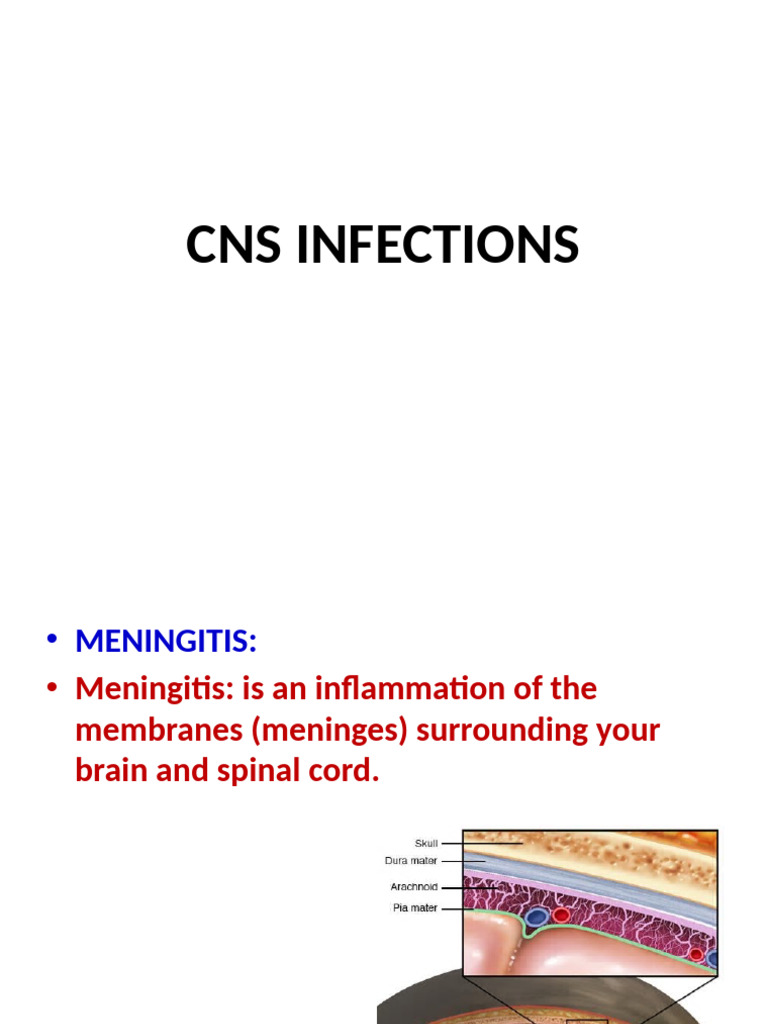 CNS Infections: Meningitis & Encephalitis Overview | PDF