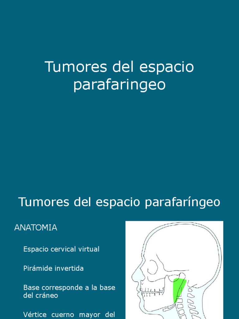 Tumores Del Espacio Parafaringeo | PDF | Anatomía humana | Cabeza y ...