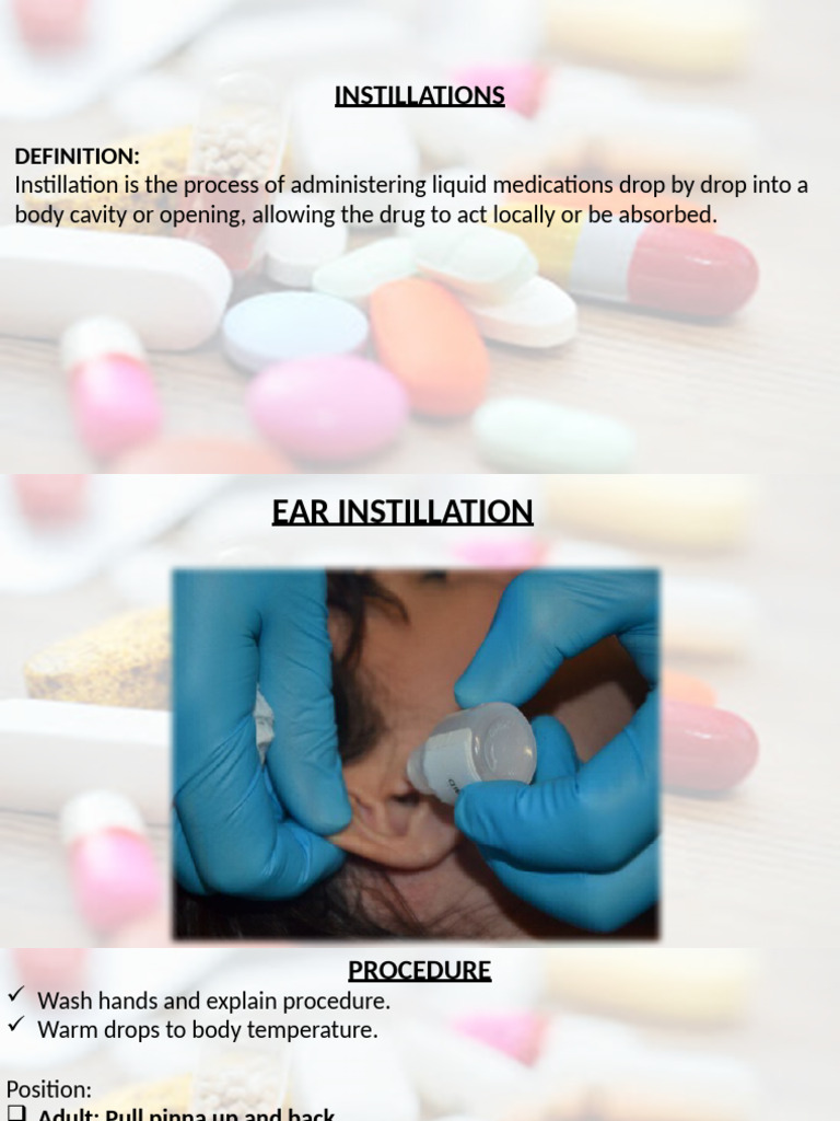 inhalation and instillation | PDF