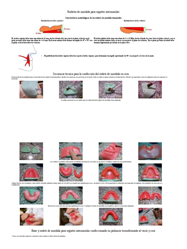 Rodetes de Mordida para Registro Intermaxilar | PDF | Naturaleza
