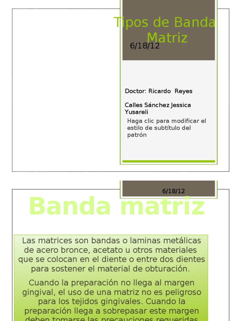 Tipos de Banda Matriz - Copy - PPTXJJJJJJJJJJ | PDF