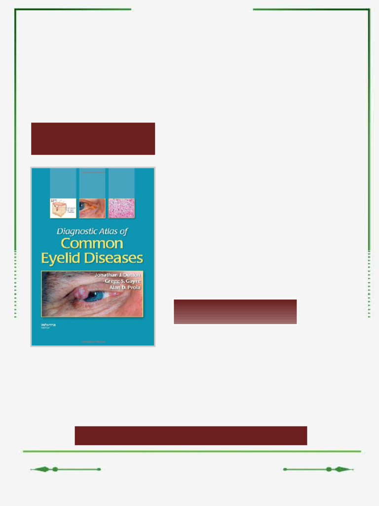 Diagnostic Atlas of Common Eyelid Diseases Informa Healthcare 1st ...