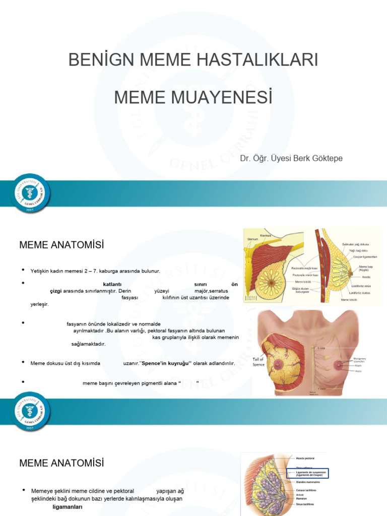 Meme Muayenesi Ve Memenin Benign Hastalıkları Son | PDF