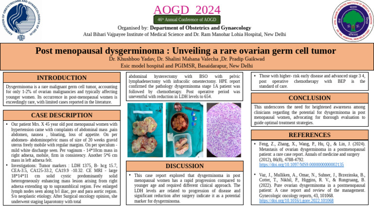Post Menopausal Dysgerminoma: Unveiling A Rare Ovarian Germ Cell Tumor ...