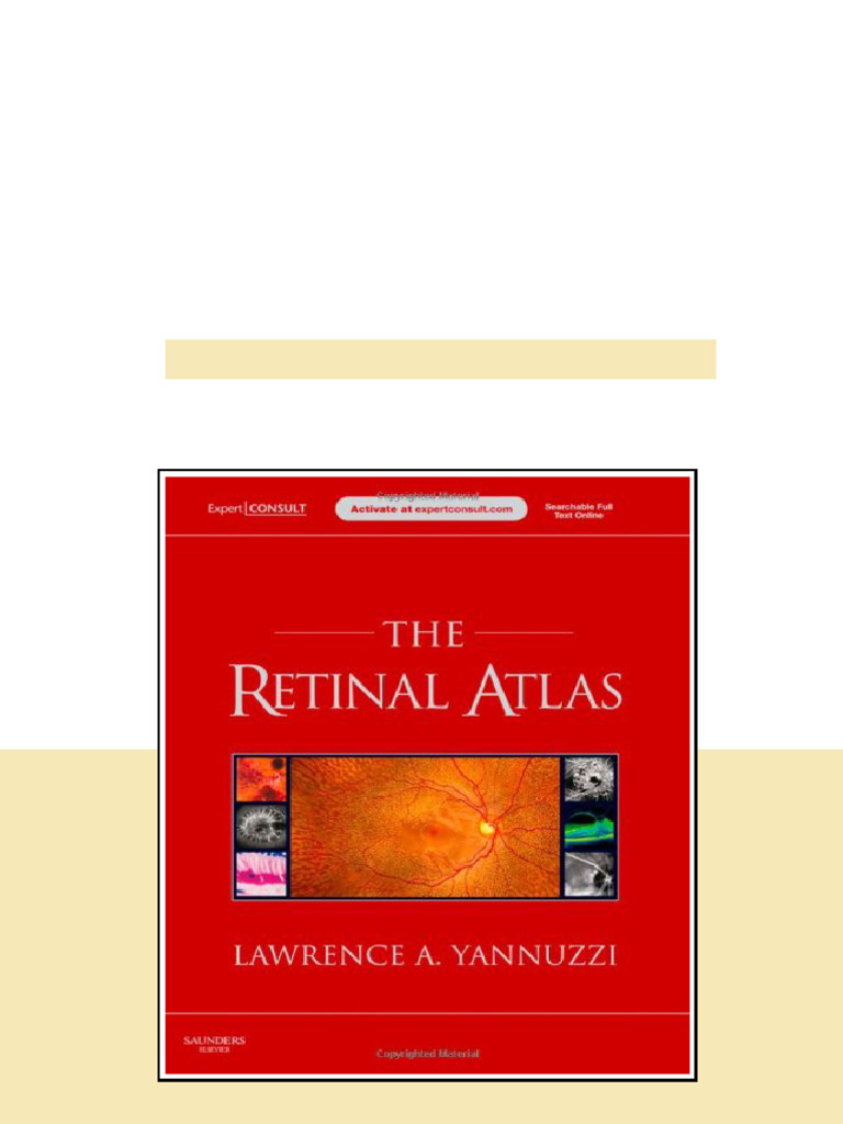 The Retinal Atlas Expert Consult Online And Print Harpsc Lawrence A ...