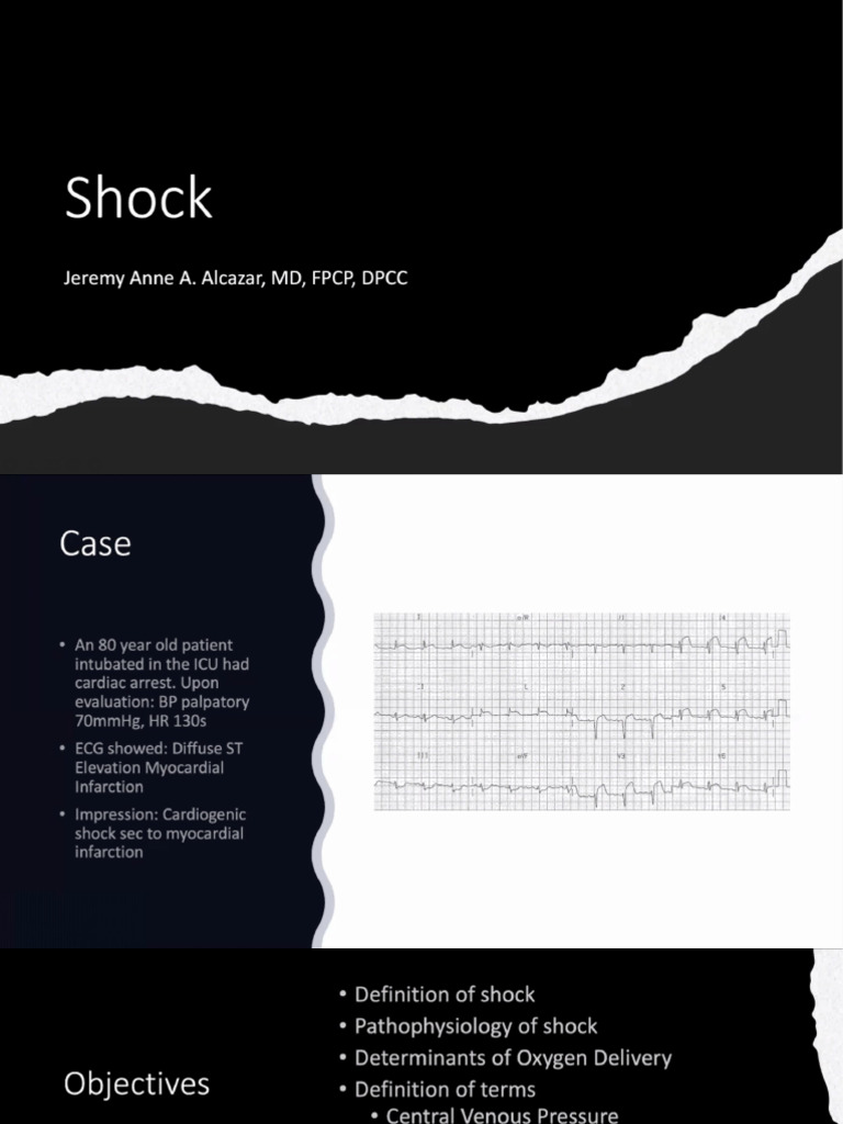 13 Shock | PDF
