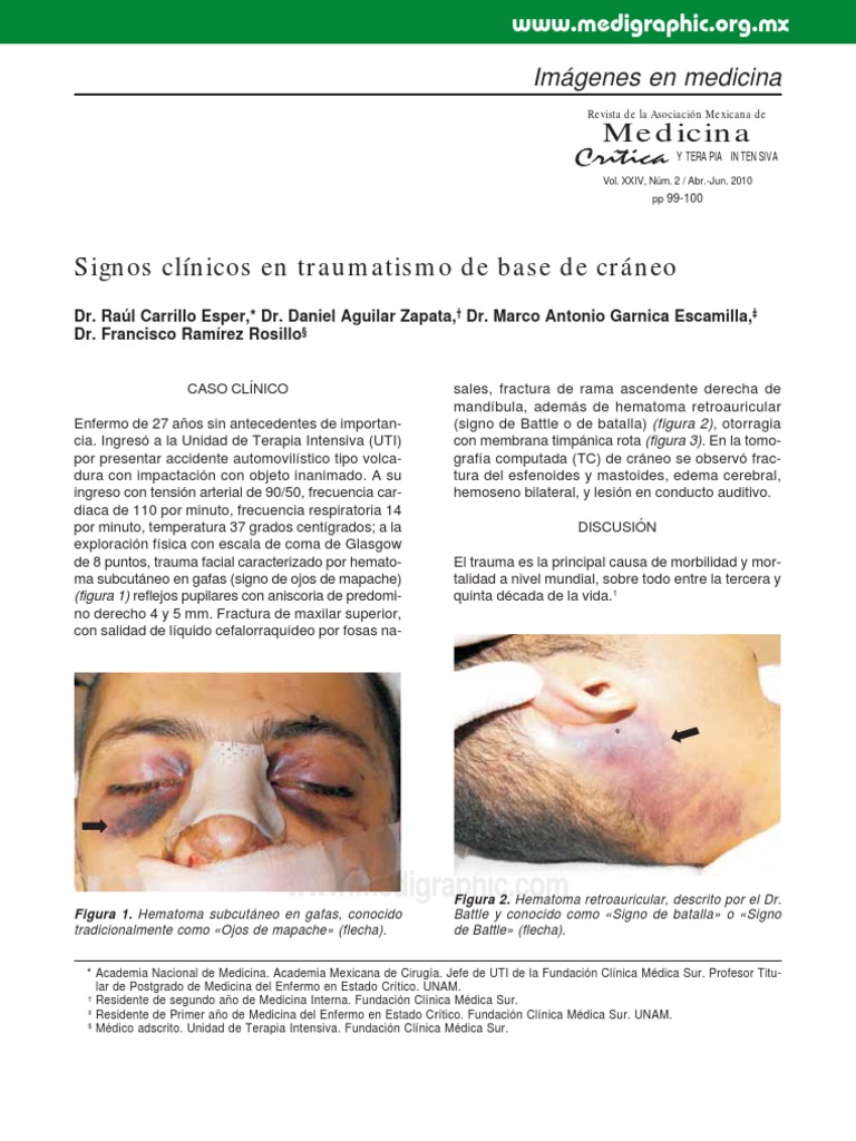 Signo de Mapache | PDF | Lesión | Medicina